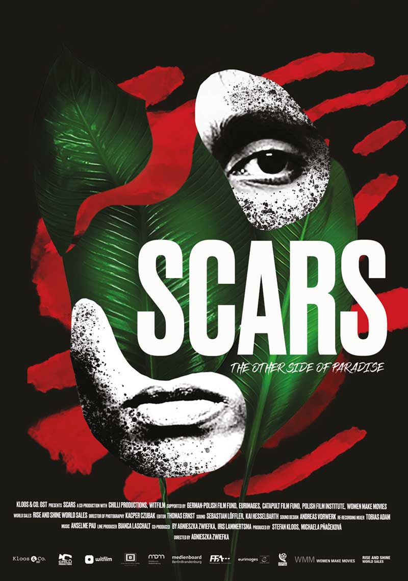 Scars 2025 Generation Of Scars On Twitter: "https://t.co/mfkmgfu7ns ...
